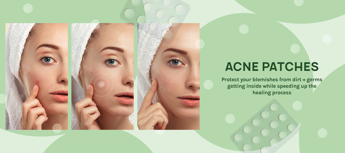 Acne Patch – Shop Miss A
