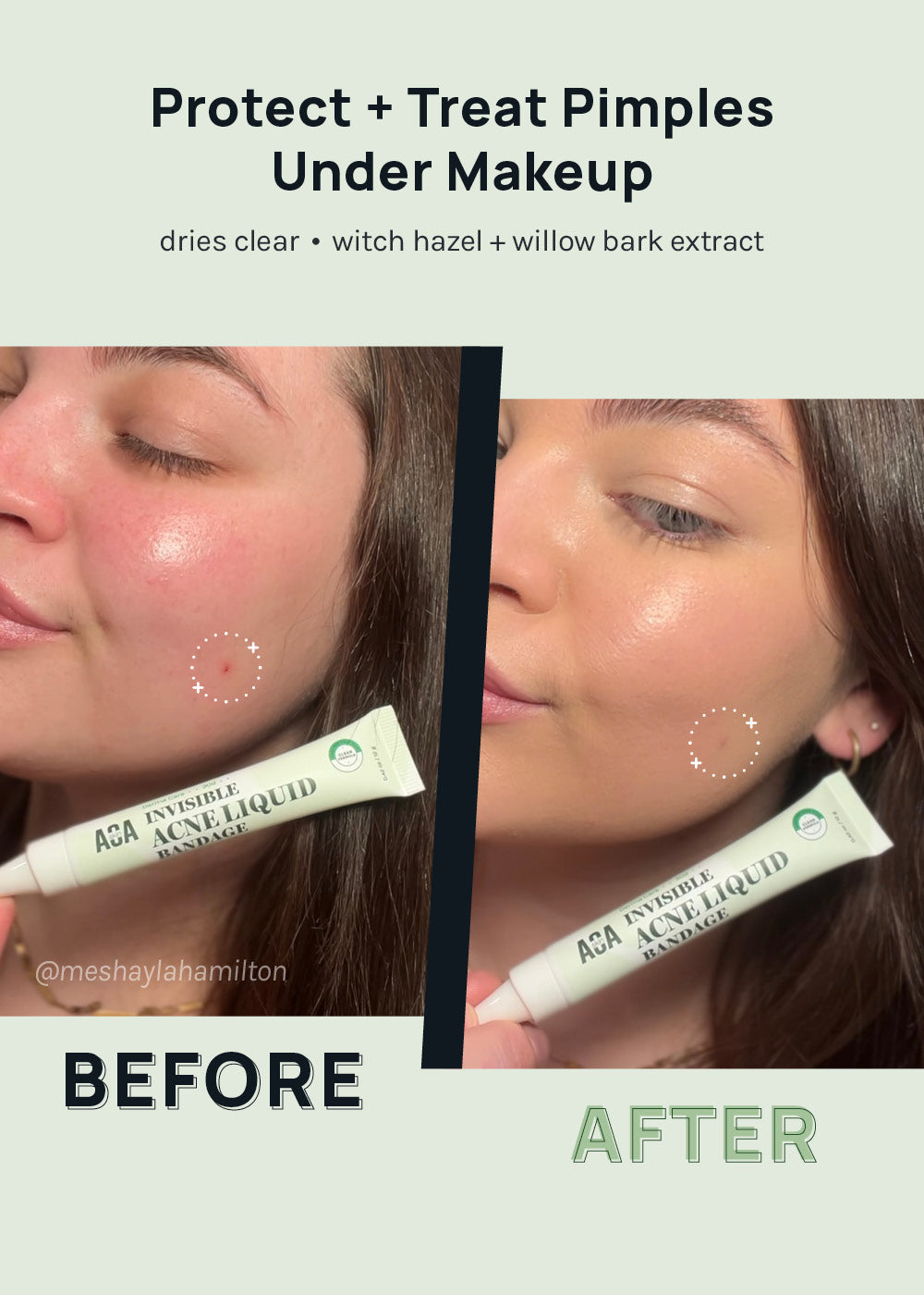 AOA Skin Invisible Acne Liquid Bandage – Shop Miss A